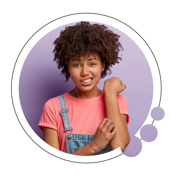 Viruela del mono - S.O.S